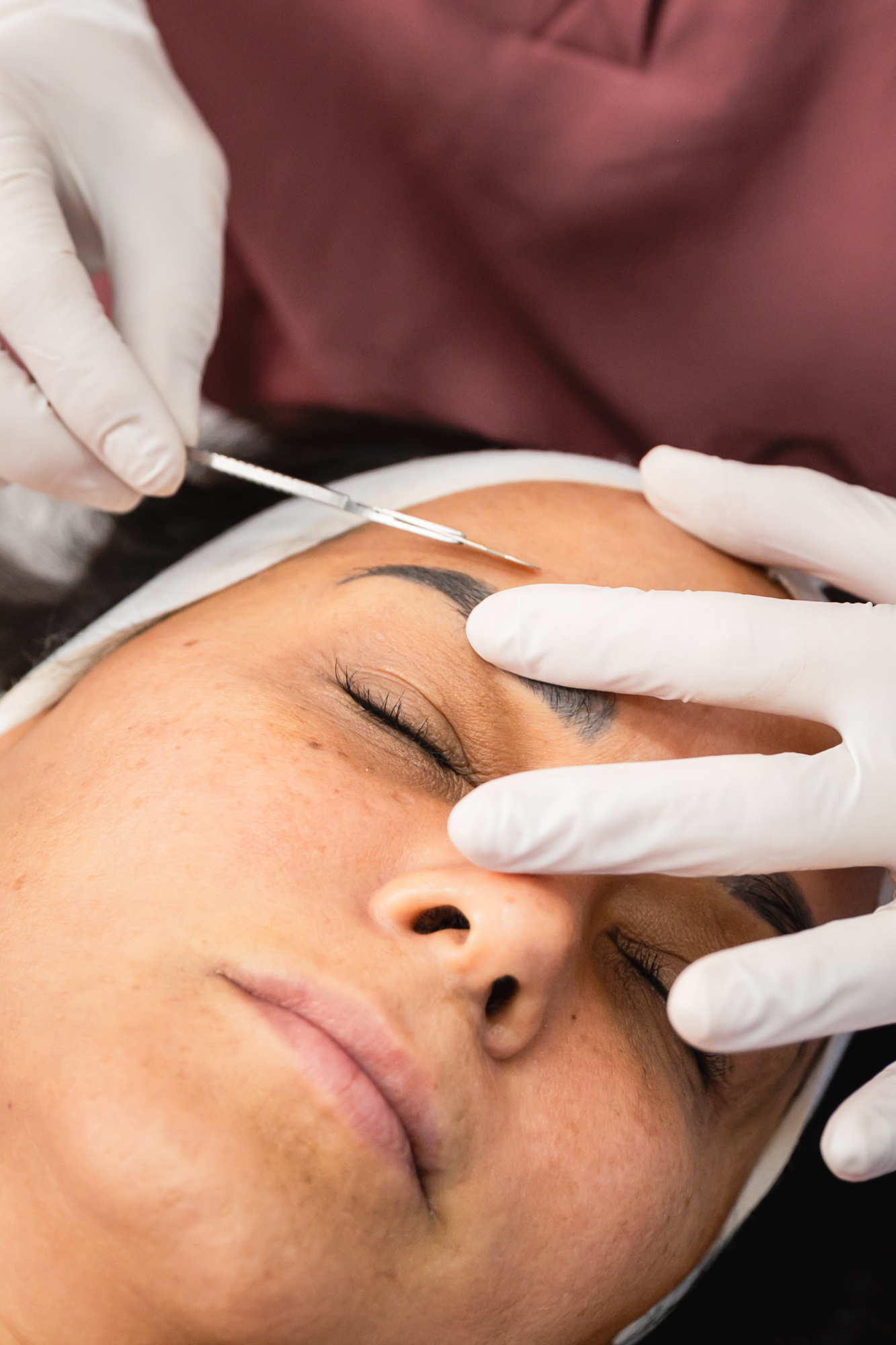 Dermaplaning in Chicago | Dvida Spa